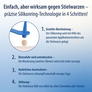 Evolsin Anti Stielwarze – Stielwarzenentferner 40 St - Shop Apotheke