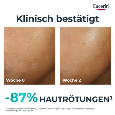 Eucerin® DERMOPURE CLINICAL Hydra Repair – Creme für trockene Haut nach ...