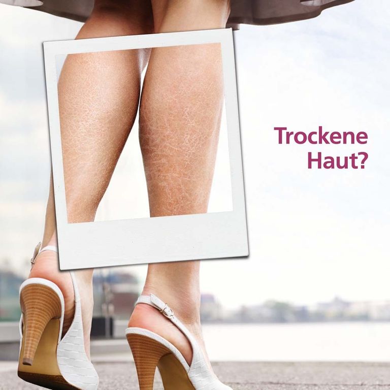 Excipial® 2 U Hydrolotio 200 ml - Shop Apotheke