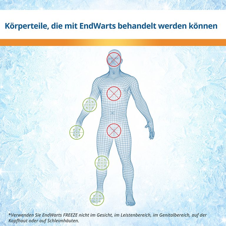 EndWarts FREEZE: Vereisungsmittel zur Entfernung von Warzen an Händen ...